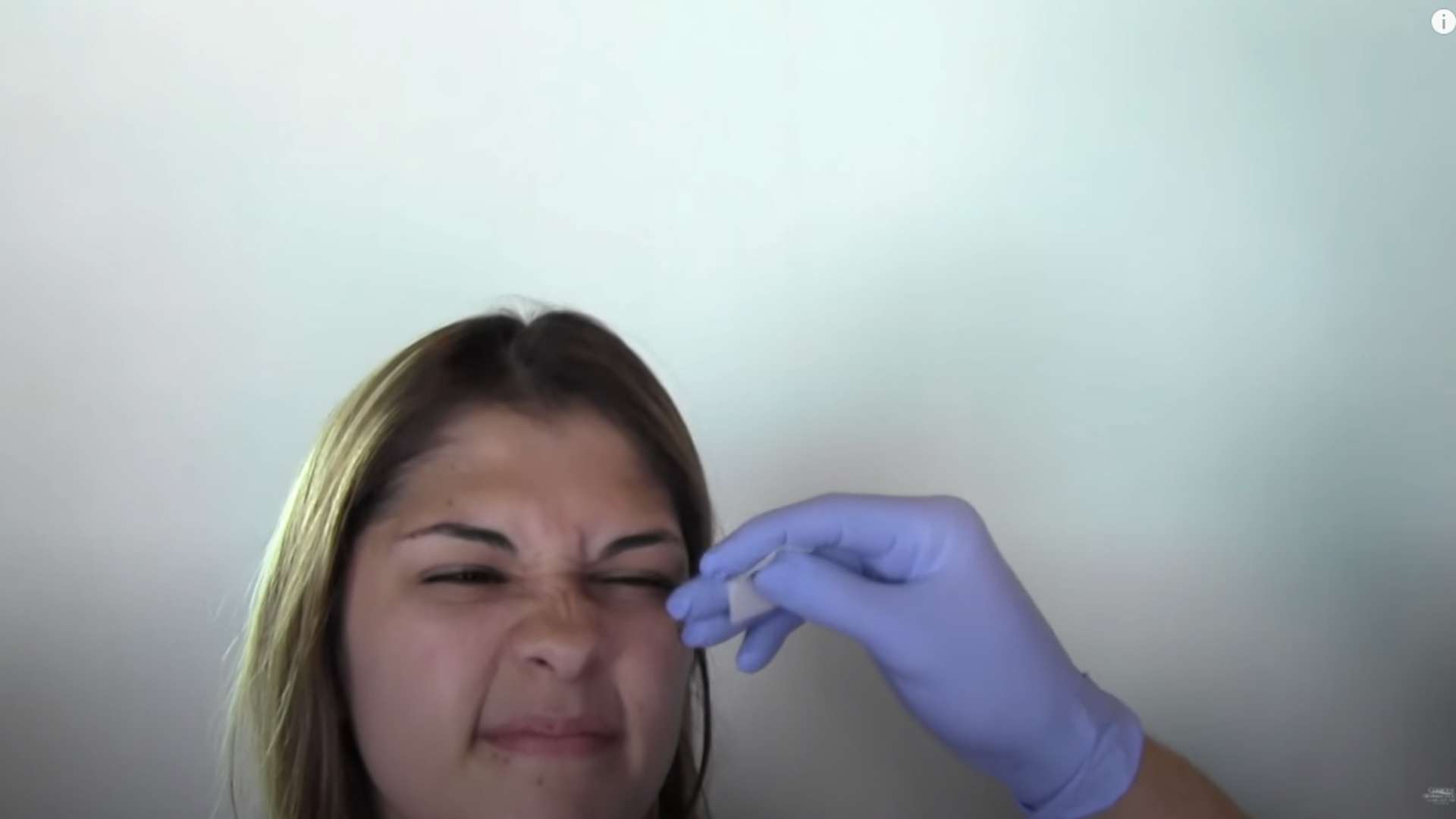 Reduce Bunny Lines and Facial Wrinkles with Botox | Video