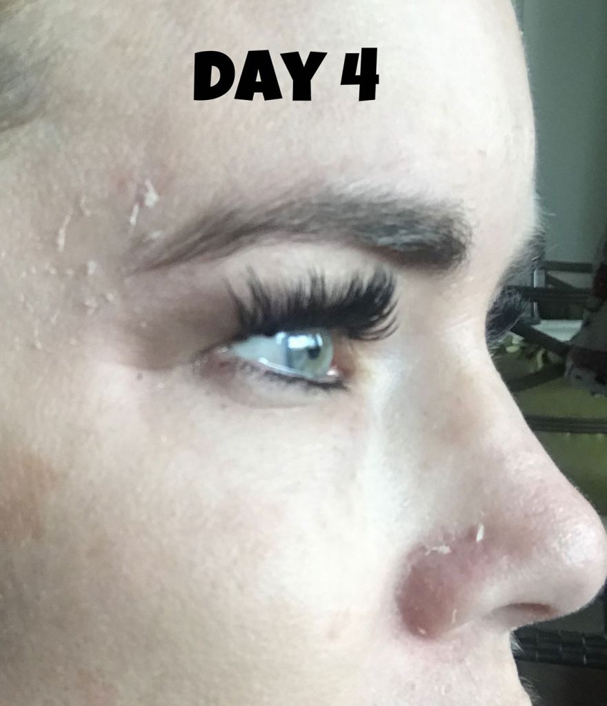 Why Chemical Peels Are So A-peel-ing | Contour Dermatology